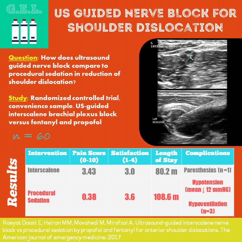 Ultrasound Guided Nerve Block for Shoulder Dislocations ...